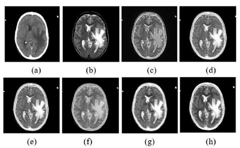 mri ct fusion a ct input b mri input c mca cs [14] d ltem