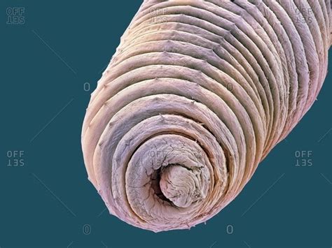 Earthworm Microscope