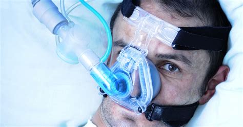 Not So Sexy Cpap Can Boost Mens Sex Lives Study Finds
