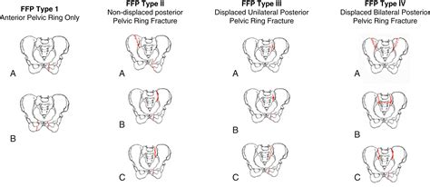 Pelvic Injuries Clinical Tree
