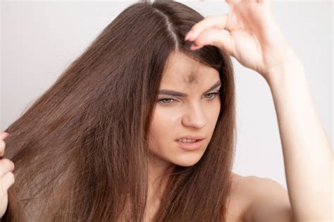 Androgenic Alopecia In Women Hair Transplant Clinic In Kolkata