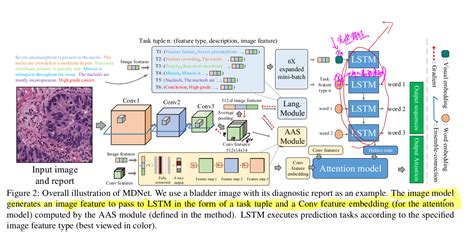 【论文笔记】cvpr 2017 Oral Mdnet 知乎