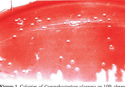 Figure 1 From A Proposal Of A Diagnostic Protocol For Isolation Of