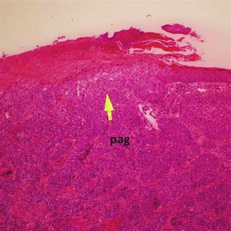 Tarsal Conjunctiva Download Scientific Diagram