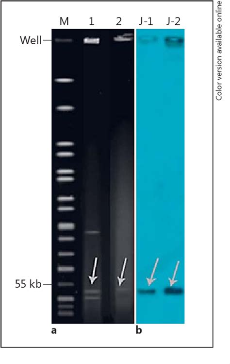 Figure 3 From An Uncommon St1224 Ndm 1 Producing Klebsiella Pneumoniae