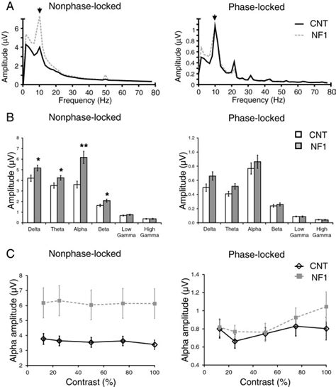 Frequency Domain Analysis Of The Electroencephalographic Eeg Download Scientific Diagram