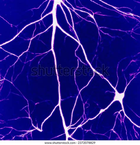 Indoor Photo Tract Axons Myelin Sheaths Ai Generated Image 2372078829