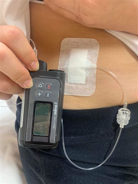 Chonos Gg Med Чонос ЖиЖи Мед