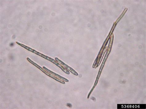 Cercospora Fungi Genus Cercospora Fresen