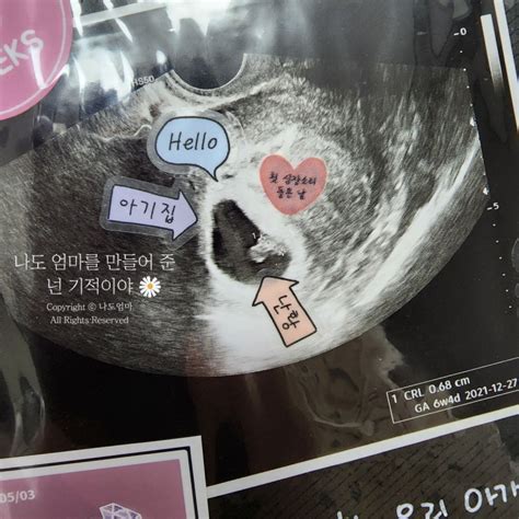 임신 착상 시기 증상 착상혈 나오는 시기 착상혈 통증 냉 수정착상기간 네이버 블로그