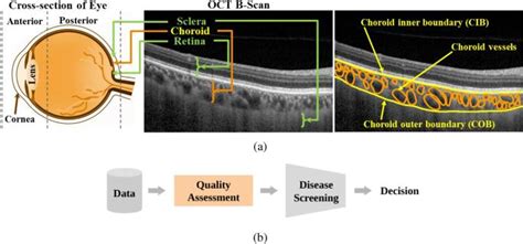 Choroidal Analysis Research Lab On Linkedin Deep Learning Based Diagnostic Quality Assessment