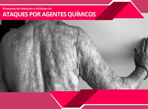 Atención Integral a Víctimas de Ataques con Agentes Químicos Cataleya