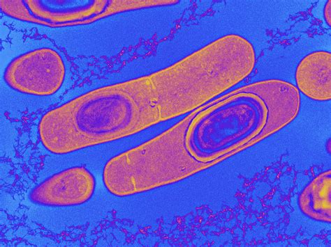 Clostridium Difficile Bacteria Tem 7 Photograph By Biomedical Imaging