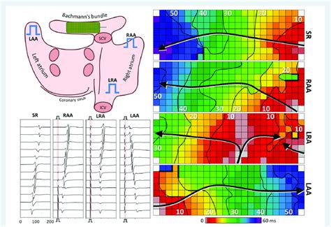 Example Of The Pacing Protocol A Schematic Scheme Of The Electrode Download Scientific