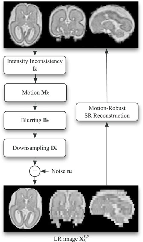 The Observation Model Of A Real MR Imaging System Relating The