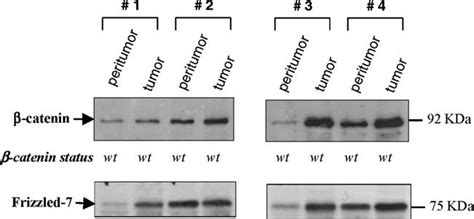 Comparison Between Fzd7 Receptor And B Catenin Protein Levels As