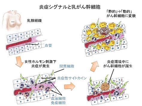 金沢大学がん進展制御研究所 分子病態研究分野 後藤研 がん幹細胞の話