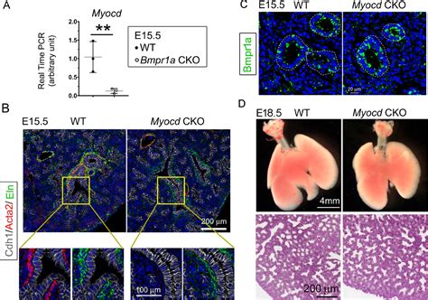 Figures And Data In Defective Mesenchymal Bmpr1a Mediated Bmp Signaling