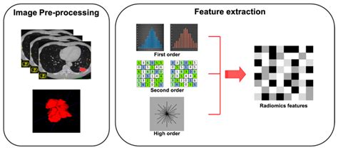 Graphical Radiomic Flowchart Of Features Extraction First Order