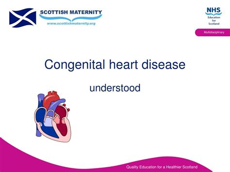 Ppt Congenital Heart Disease Powerpoint Presentation Free Download