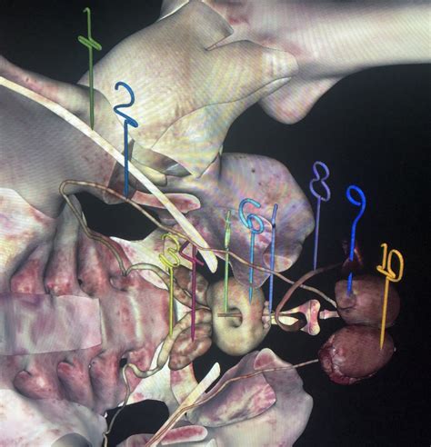 Lab Final 4 Diagram Quizlet