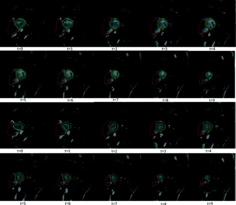 The Cardiac Segmentation Results At Test Time By Rnn Gan From Acdc