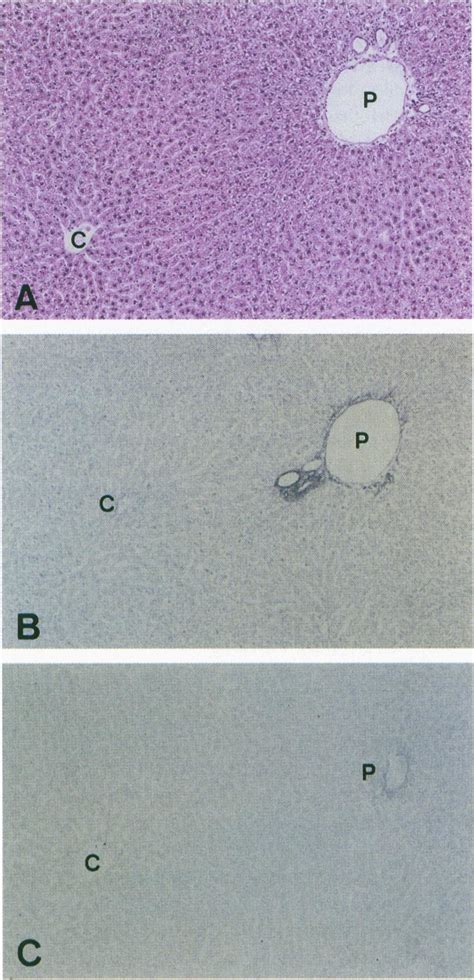 Mgmt Mrna Expression Detected By In Situ Hybridization In Liver Of