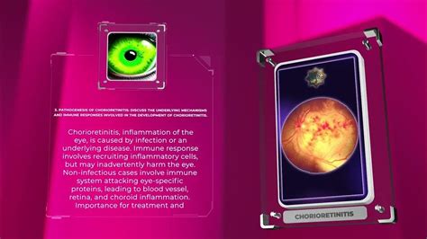 Chorioretinitis Youtube
