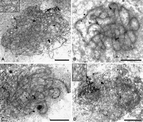 Electron Micrographs Of Silver Stained Zygotene Pachytene Nuclei A Download Scientific