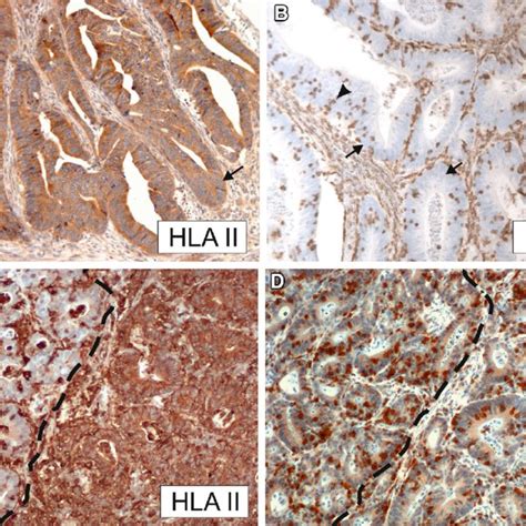 Representative Immunohistochemical Stainings With The Hla Class Ii