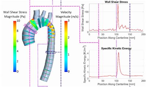 Deep Learning Based Centerline Aggregated Aortic Hemodynamics An Efficient Alternative To