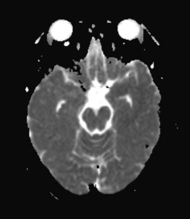 Image Radiopaedia Org