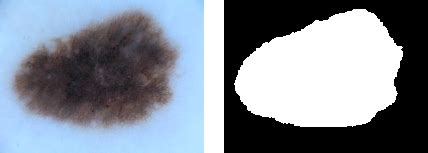 GitHub Mdbloice Augmentor Image Augmentation Library In Python For Machine Learning