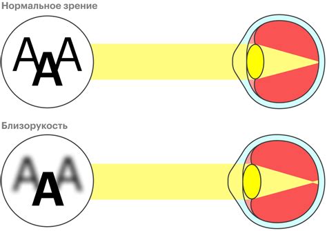 Портится ли зрение от компьютера, как работа за монитором может вредить ...