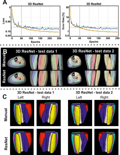Unet Neural Network For 2d And 3d Image Segmentation W Medical Examples