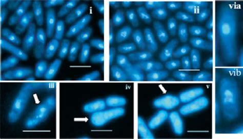 Altered Cellular And Nuclear Morphology Of Fission Yeast Cells After