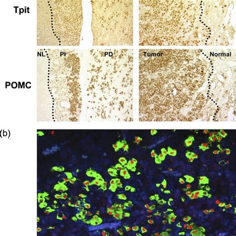 A Immunohistochemical Analysis Of Pituitary T Box Transcription Download Scientific Diagram