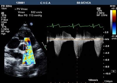 Echo 240 Midterm Flashcards Quizlet Echo 240 Midterm Flashcards Quizlet