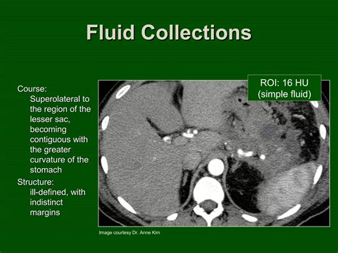 Imaging Acute Pancreatitis Ppt