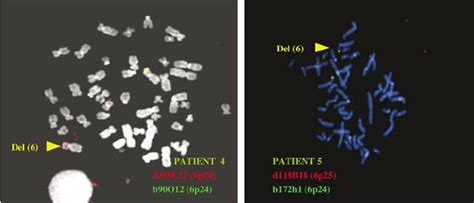 Examples Of Results Showing Metaphase Chromosomes Prepared From A Download Scientific Diagram