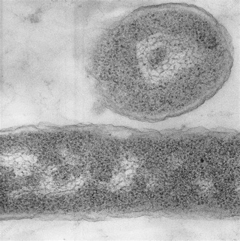 Escherichia Coli Tem Stock Image C0556045 Science Photo Library