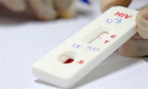 INFARMED PROÍBE COMERCIALIZAÇÃO DE TESTES RÁPIDOS DE HIV RÁDIO