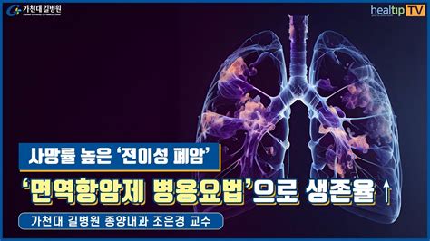 사망률 높은 ‘전이성 폐암 ‘면역항암제 병용요법으로 생존율↑ Youtube