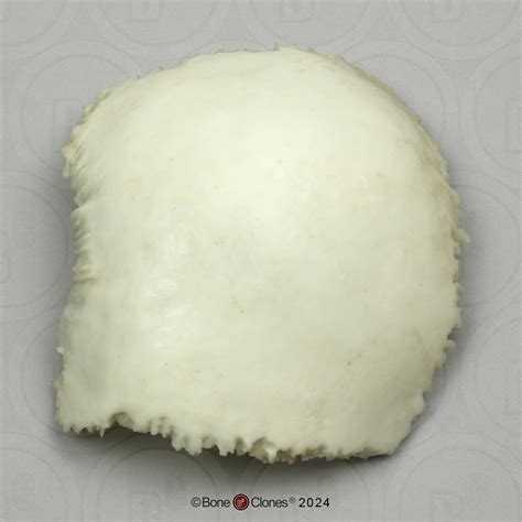 Human Parietal Right Bone Clones Osteological Reproductions