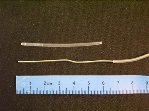 Figure 2 From Acute Airway Obstruction By A Sheared Endotracheal