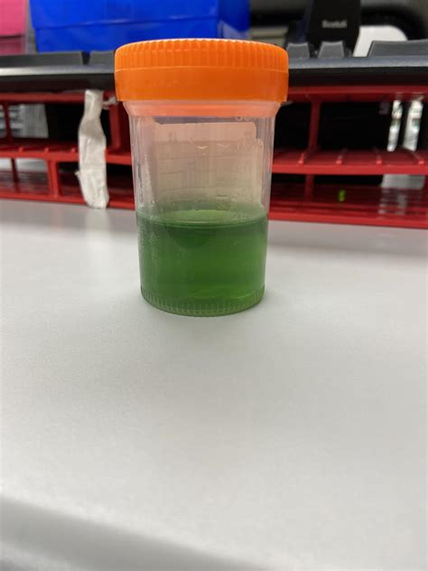Green Urine