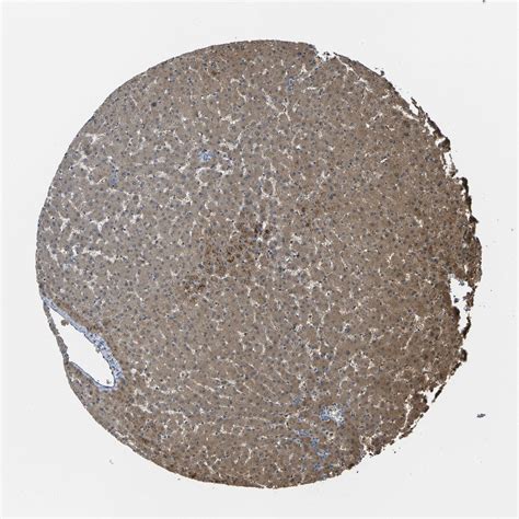 Tissue Expression Of Ednra Staining In Liver The Human Protein Atlas