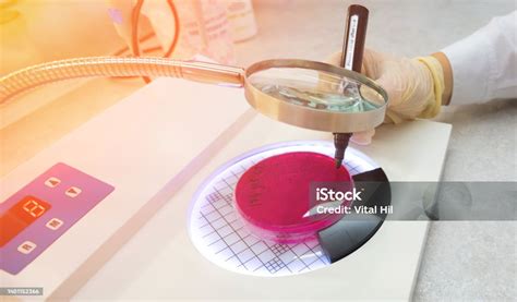 한 과학자는 페트리 접시에 에오신 메틸렌 블루 에이산 메틸렌 블루 에 배양 에샤리치아 대장균 박테리아의 식민지를 계산 문화에 대한 스톡 사진 및 기타 이미지 Istock