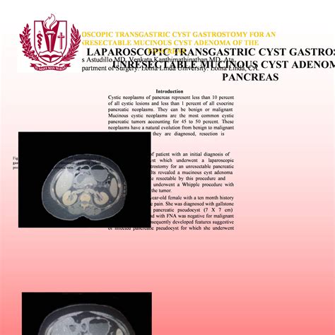 Laparoscopic Transgastric Cyst Gastrostomy For An Unresectable Mucinous