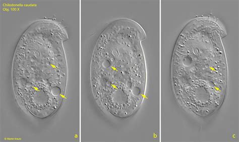 Chilodonella Caudata Real Micro Life